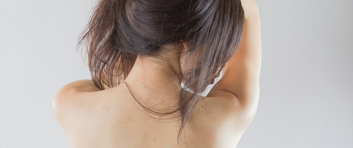 does burning turn into tan